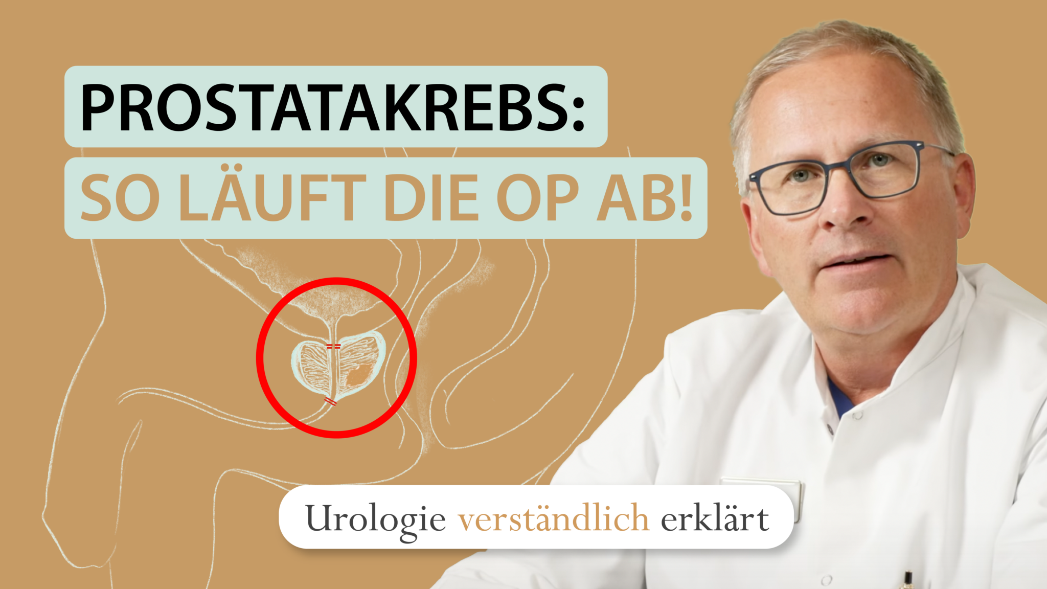 Vital in der Region - Urologie – verständlich erklärt: Prostatakrebs mit dem da Vinci Roboter ...